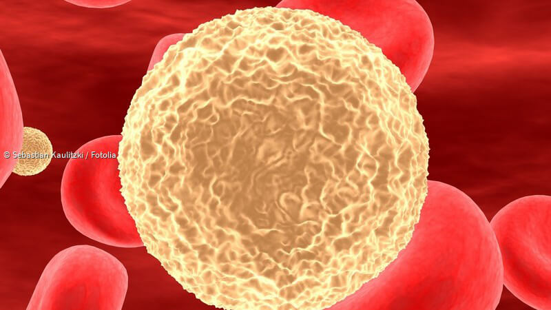 ᐅ Der Autoimmunkrankheit Lupus auf der Spur: Forscher finden wichtigen ...