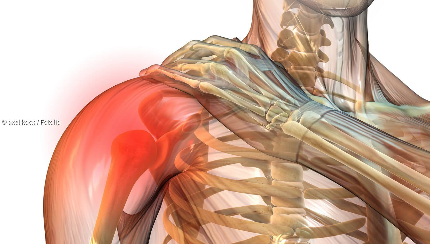 Kurzmeldungen zum Thema Armschmerzen - paradisi.de