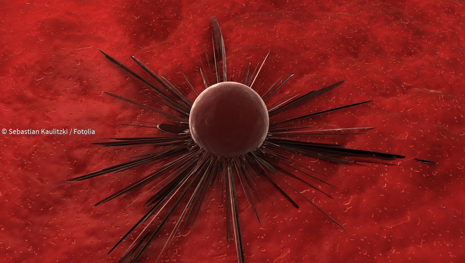 Kurzmeldungen zum Thema Spinaliom - paradisi.de
